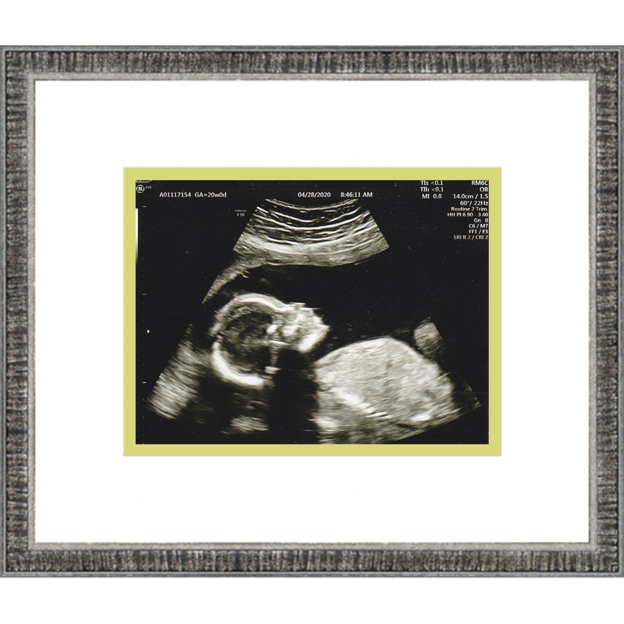 Rustic Silver Sonogram Frame with Double Mats | Frames for Ultrasounds