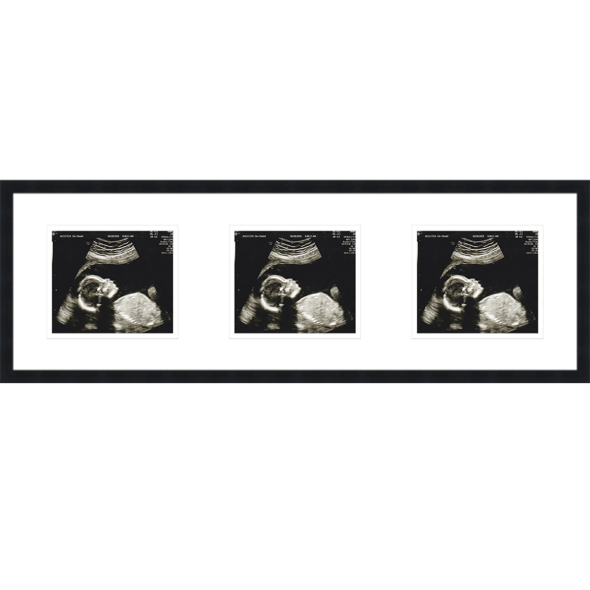 Black Sonogram Frame with Double Mats for 3 Images | Frames for Ultrasounds